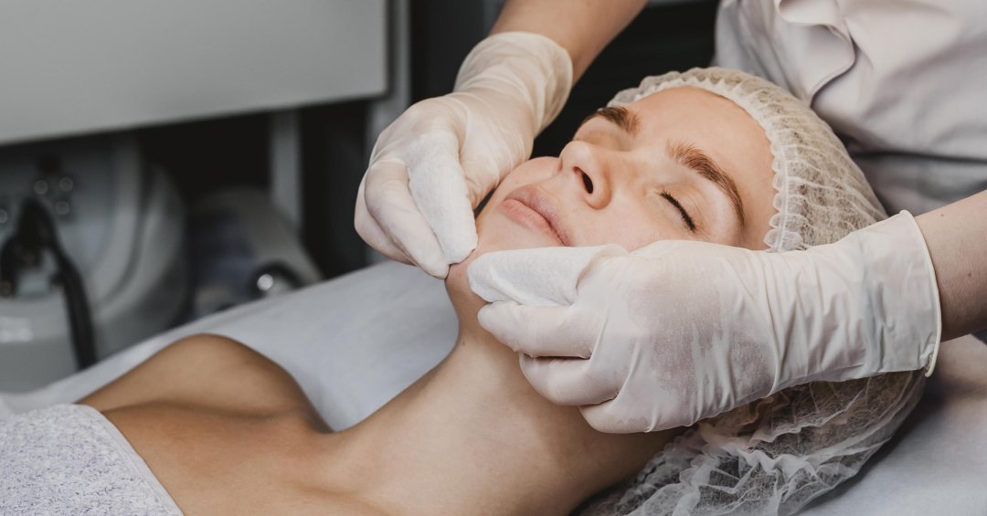 Peeling de fenol: 5 passos para garantir a segurança do procedimento